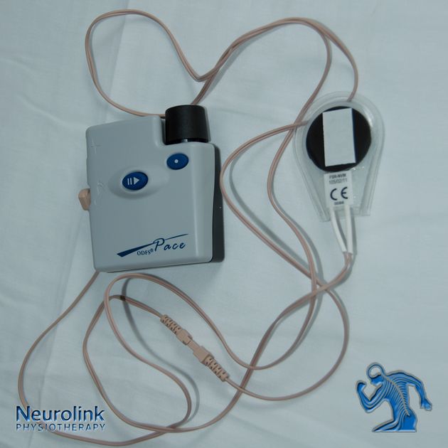 What is the PACE FES system and how does it work?, Natalie Woodman