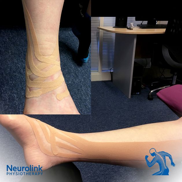 4 Ways To Reduce Lower Leg And Ankle Swelling This Summer, Natalie Woodman