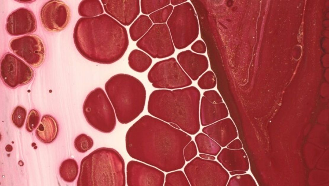 SOHO ALERT: A Comprehensive Guide to the Proposed Regulation on ...