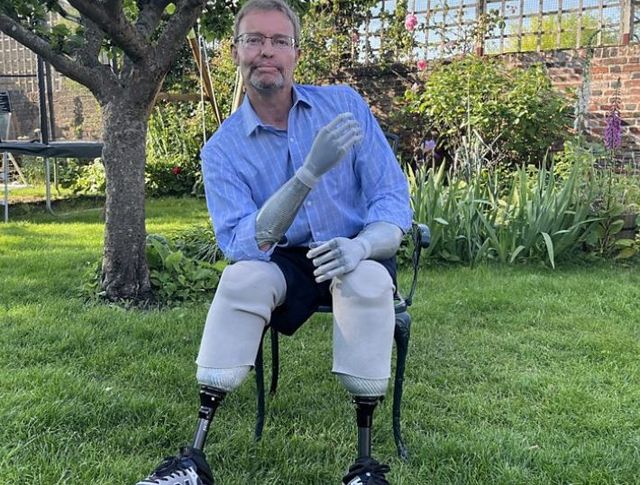 As Craig Mackinlay MP shares his sepsis story what are the signs of the ...