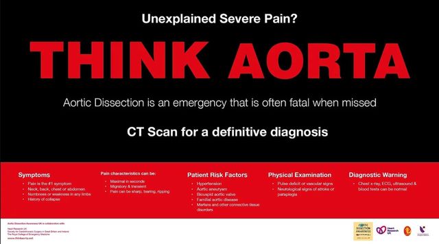 What is aortic dissection and the need for more awareness around the ...